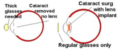 Lobo Eye Clinic